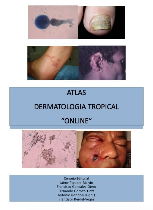 Gran Atlas de Dermatología Tropical – PIEL-L Latinoamericana