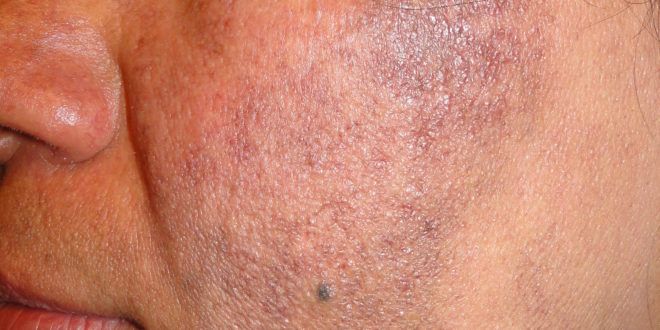 Close Up Nº 406 – PIEL-L Latinoamericana