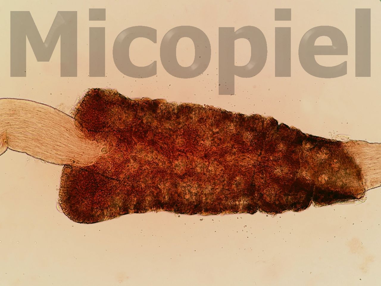 Portafolio fotográfico digital de un tallo piloso con piedra negra ...