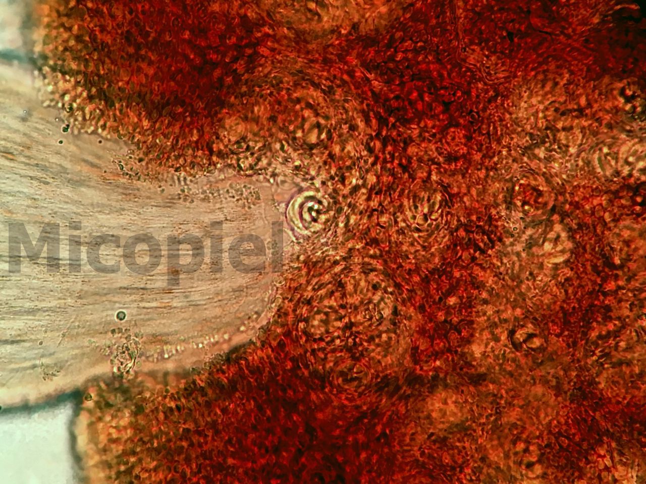 Portafolio fotográfico digital de un tallo piloso con piedra negra ...