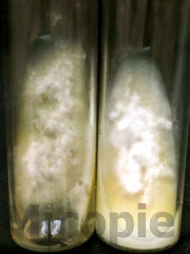 Caso clínico Nº 76. Dermatofitosis en pubis – PIEL-L Latinoamericana