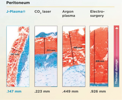 Plasma frío atmosférico. Una novedosa tecnología para el dermatólogo ...