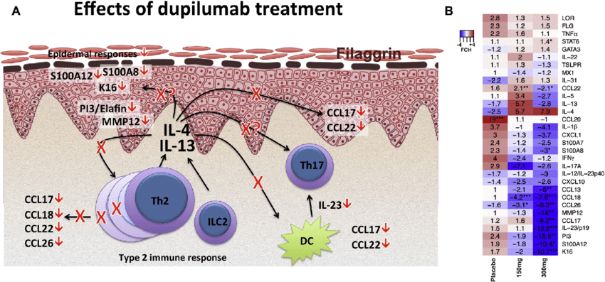 Dupilumab y Dermatitis Atópica – PIEL-L Latinoamericana