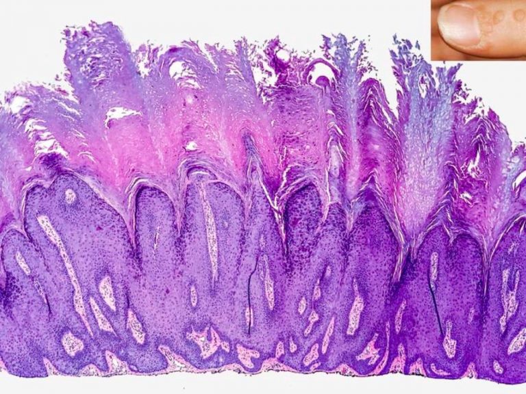 Caso histológico para diagnóstico Ed.438 – PIEL-L Latinoamericana