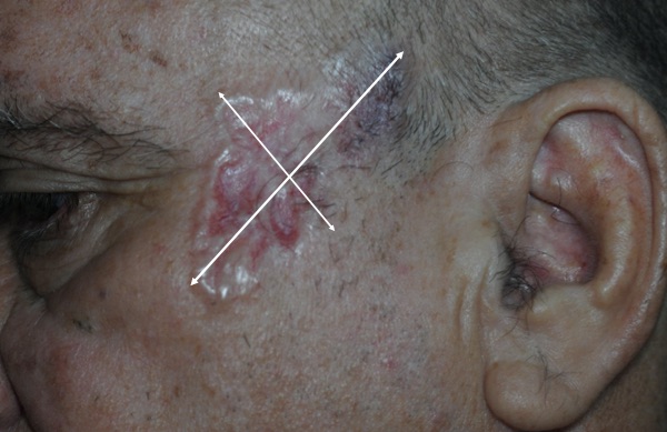 Escalpelo Edición 459 – PIEL-L Latinoamericana