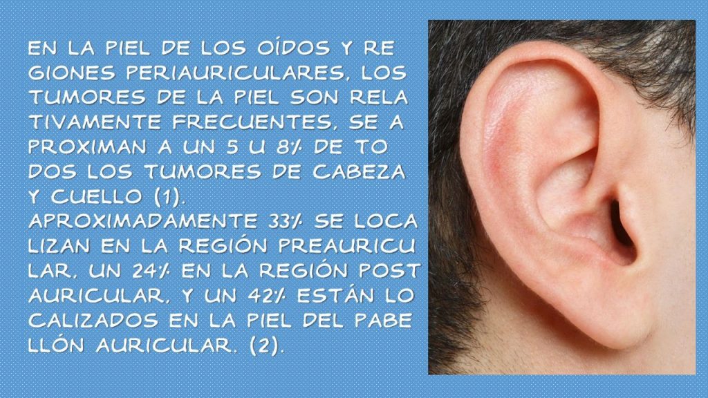 Carcinoma basocelular en la concha auricular. ¿Cómo lo reparamos ...