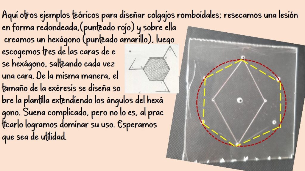 Plantilla para facilitar el diseño de un colgajo romboidal – PIEL-L ...