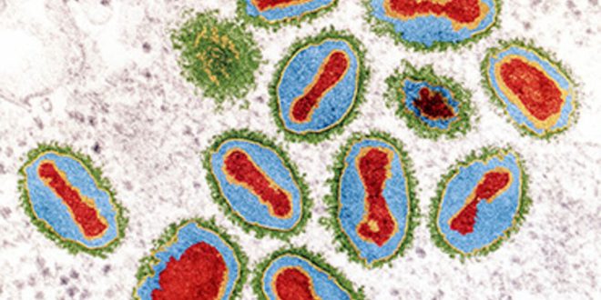 Dermatología en cuadros: SMALLPOPX ( Variola) – PIEL-L Latinoamericana