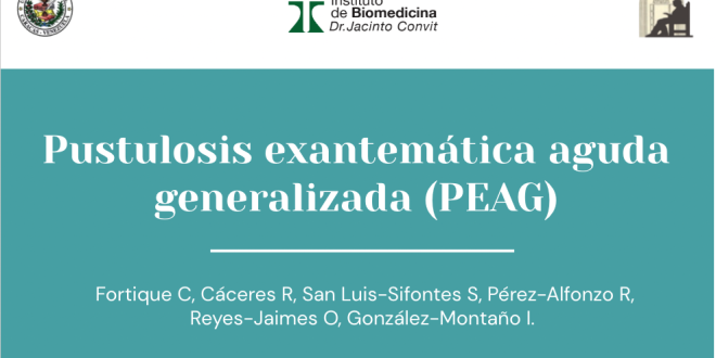 Pustulosis exantemática aguda generalizada (PEAG) – PIEL-L Latinoamericana