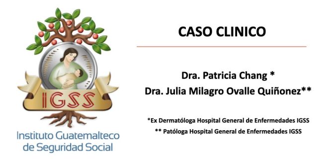 Ocronosis exógena – PIEL-L Latinoamericana