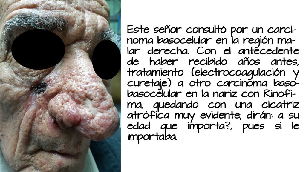 Iatrogenia o Mala Praxis – PIEL-L Latinoamericana