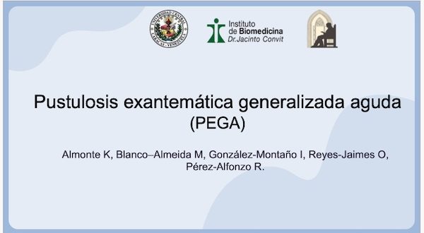 Pustulosis exantemática generalizada aguda (PEGA) – PIEL-L Latinoamericana