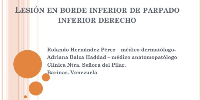 Lesión en borde inferior de parpado inferior derecho – PIEL-L ...