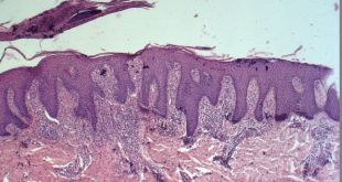 La piel a través del microscopio – PIEL-L Latinoamericana