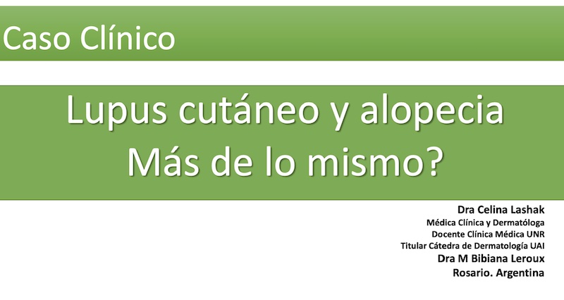 Lupus cutáneo y alopecia. ¿Más de lo mismo? – PIEL-L Latinoamericana