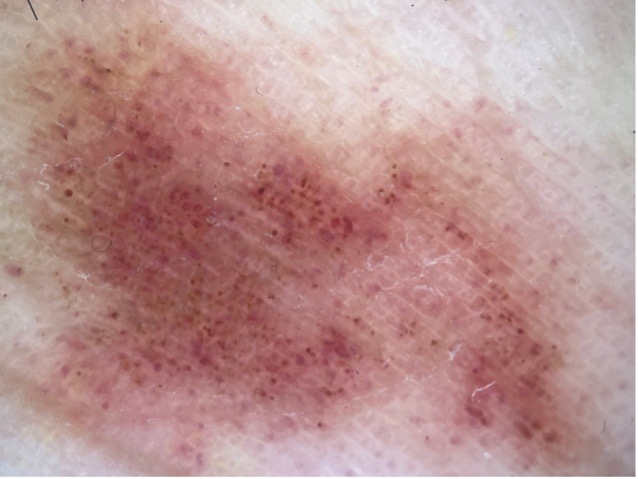 Close-Up Nº 467 – PIEL-L Latinoamericana